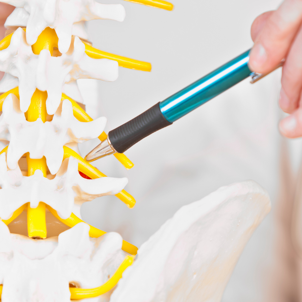 Pain Management Solutions - Michigan Sports and Spine Center